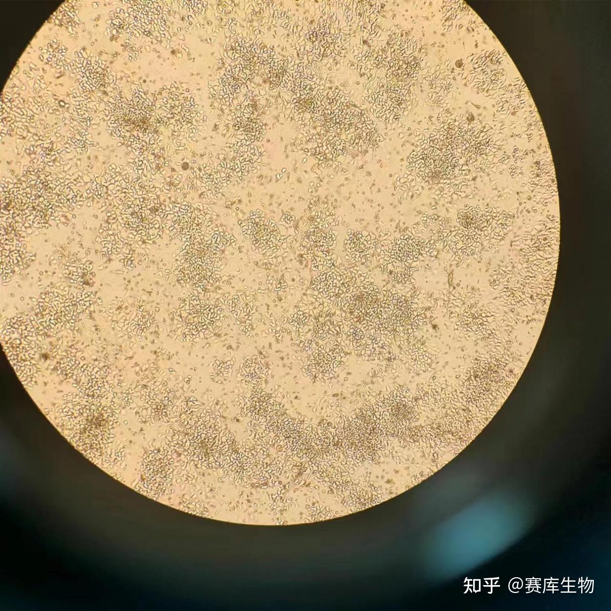 细胞学堂|SK-BR-3人乳腺癌细胞的生长特性及常见问题 - 知乎