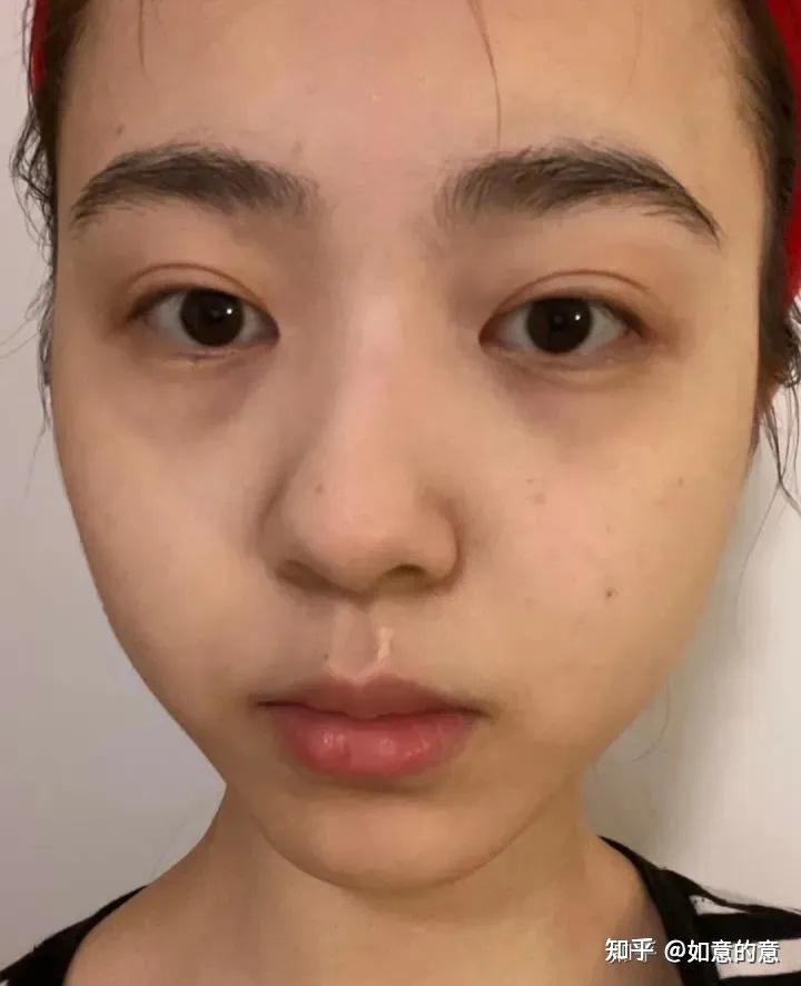 见效最快的美白成分是什么？ 知乎
