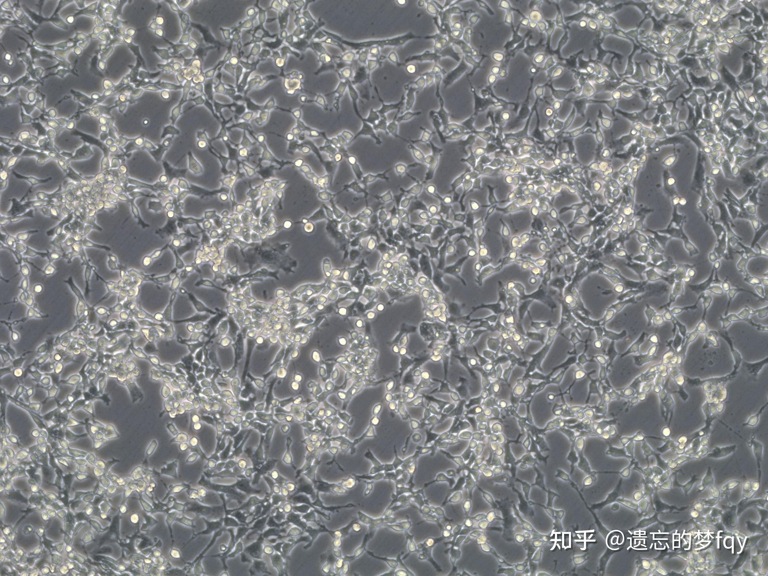 细胞形态之MLE-12 - 知乎