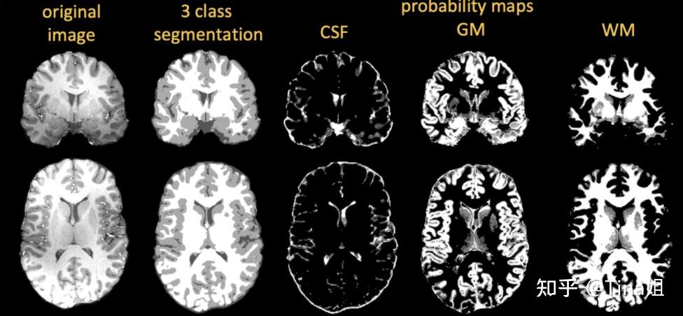介绍一款 MRI&CT 图像预处理强大工具--FSL - 知乎