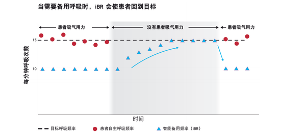 5分钟带你认识瑞思迈呼吸机——Lumis150 VPAP ST - 知乎
