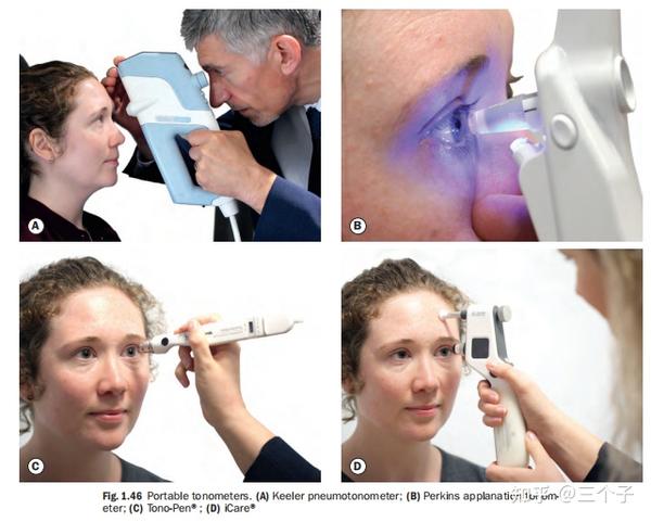 No.23,Other forms of tonometry - 知乎