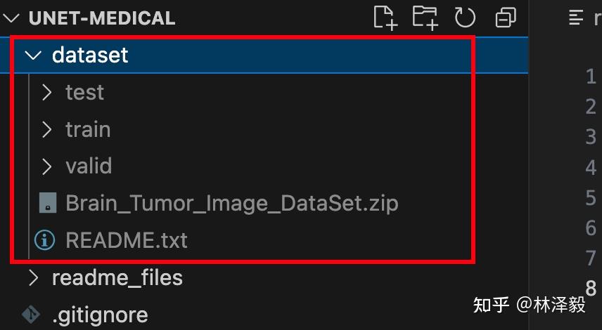 UNet脑瘤医学影像分割训练实战（PyTorch 完整代码） - 知乎