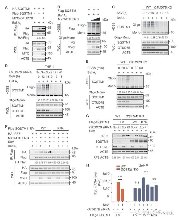 Autophagy | OTUD7B去泛素化SQSTM1/p62 并促进IRF3 降解以调节抗病毒免疫 - 知乎