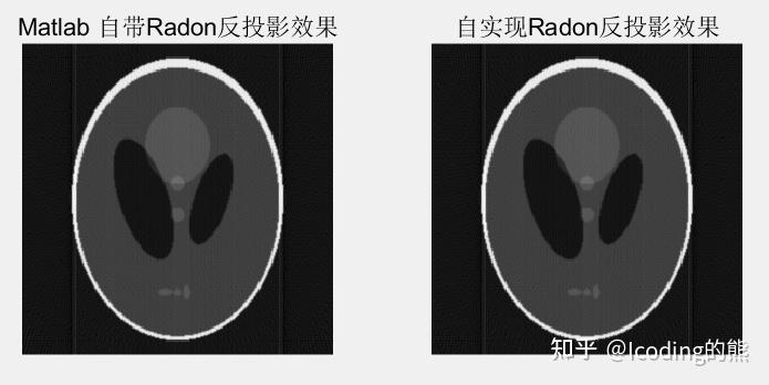 Radon变化的matlab实现 - 知乎