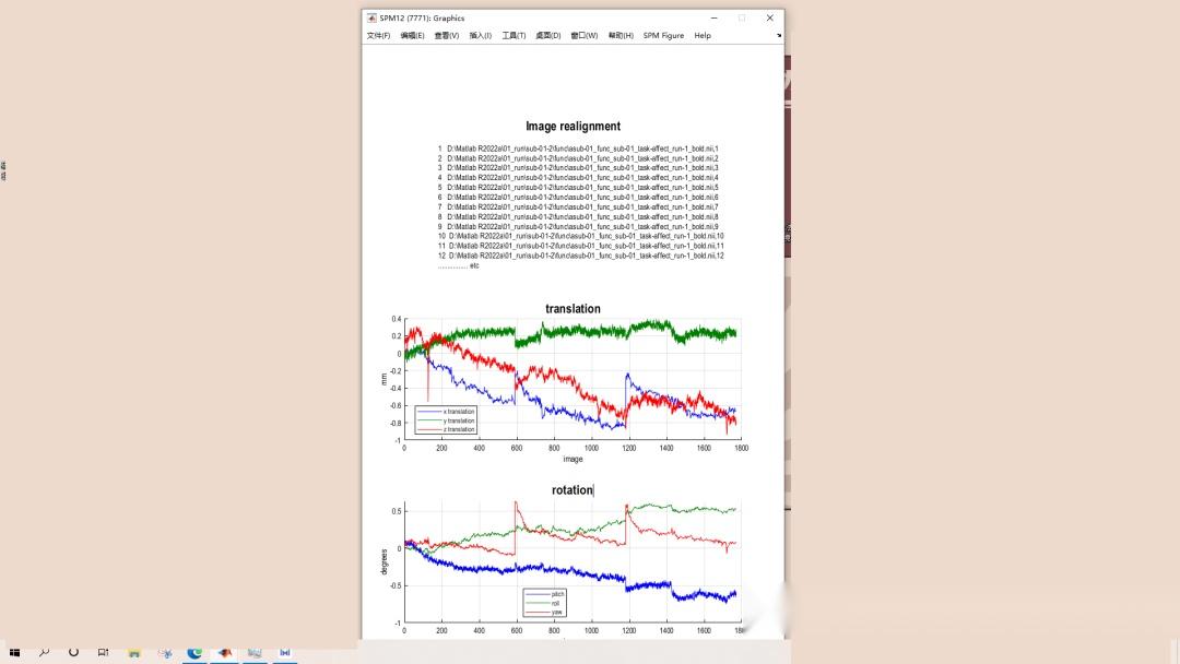 如何用SPM完成fMRI数据的预处理【任务态】 - 知乎