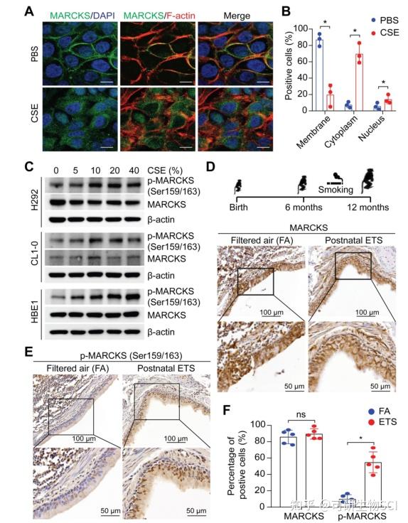 文献精读：MARCKS与NKAP联合激活烟雾相关肺癌中的 NF-kB 信号 - 知乎