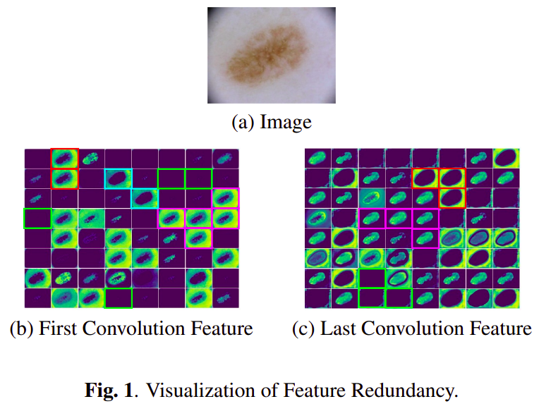 【arXiv:2201】GPU-Net：具有更多样化特征的轻量级 U-Net - 知乎