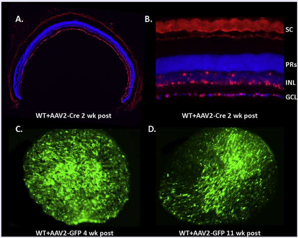 腺相关病毒AAV在眼科中应用研究 - 知乎