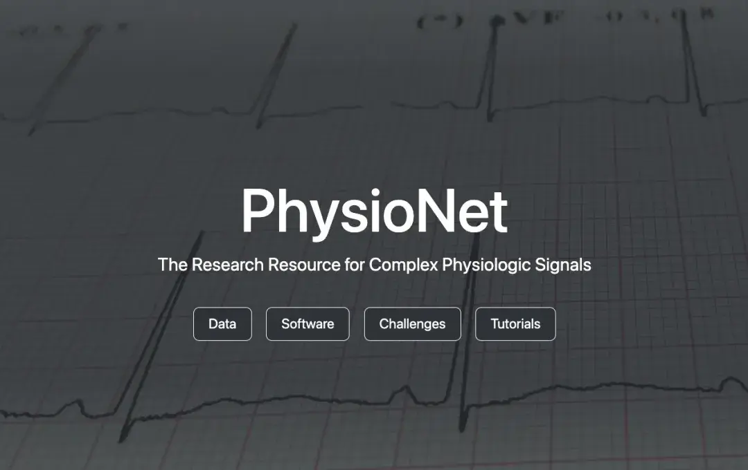 脑电(EEG)公开数据集/平台汇总 - 知乎