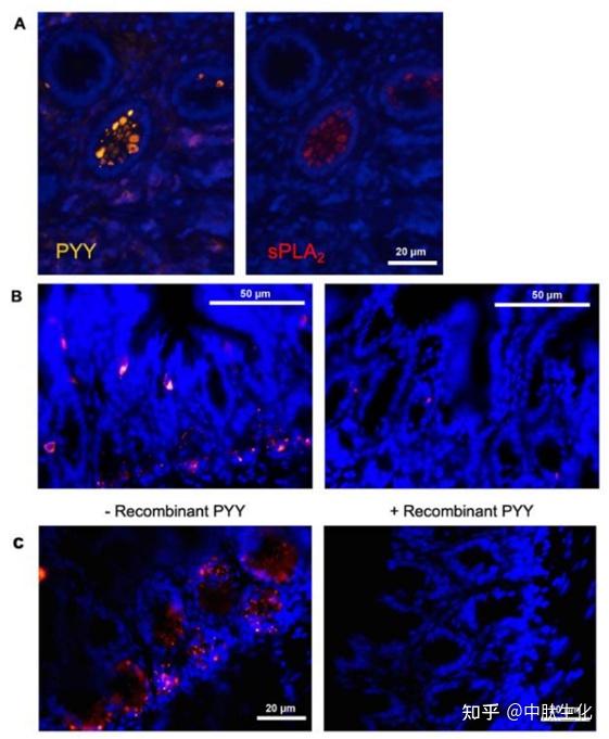 Science：意外！控制食欲的肠道激素PYY也在调节真菌微生物组中起着重要作用 - 知乎