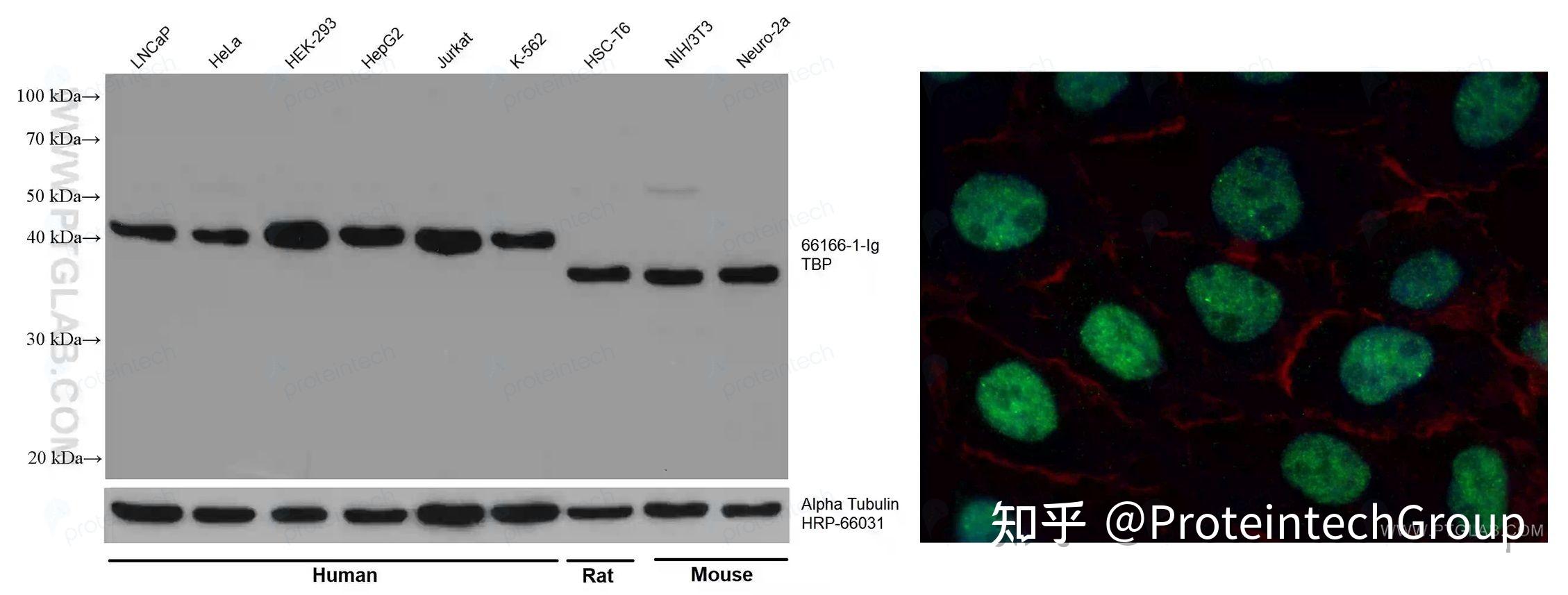 WB指南 | 18种常用WB内参大盘点！码住！ - 知乎
