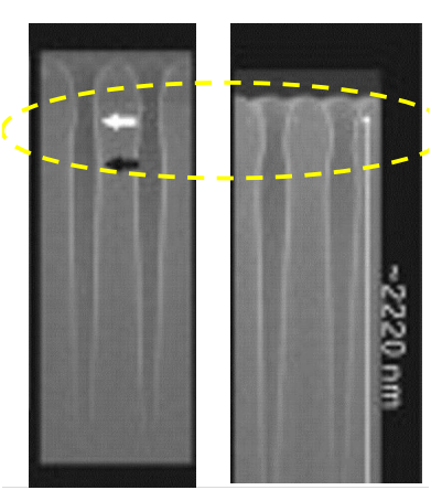 Dry Etch (2) - 知乎