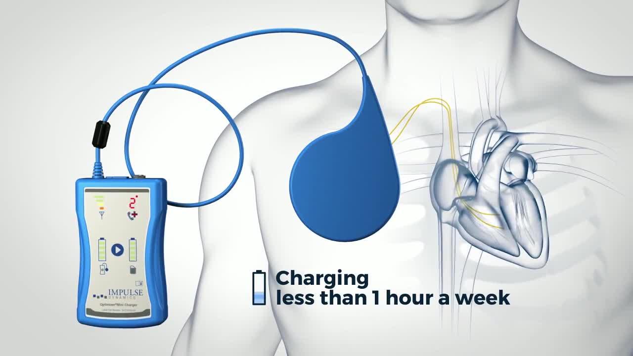 OPTIMIZER Smart系统——慢性心衰治疗新突破 - 知乎