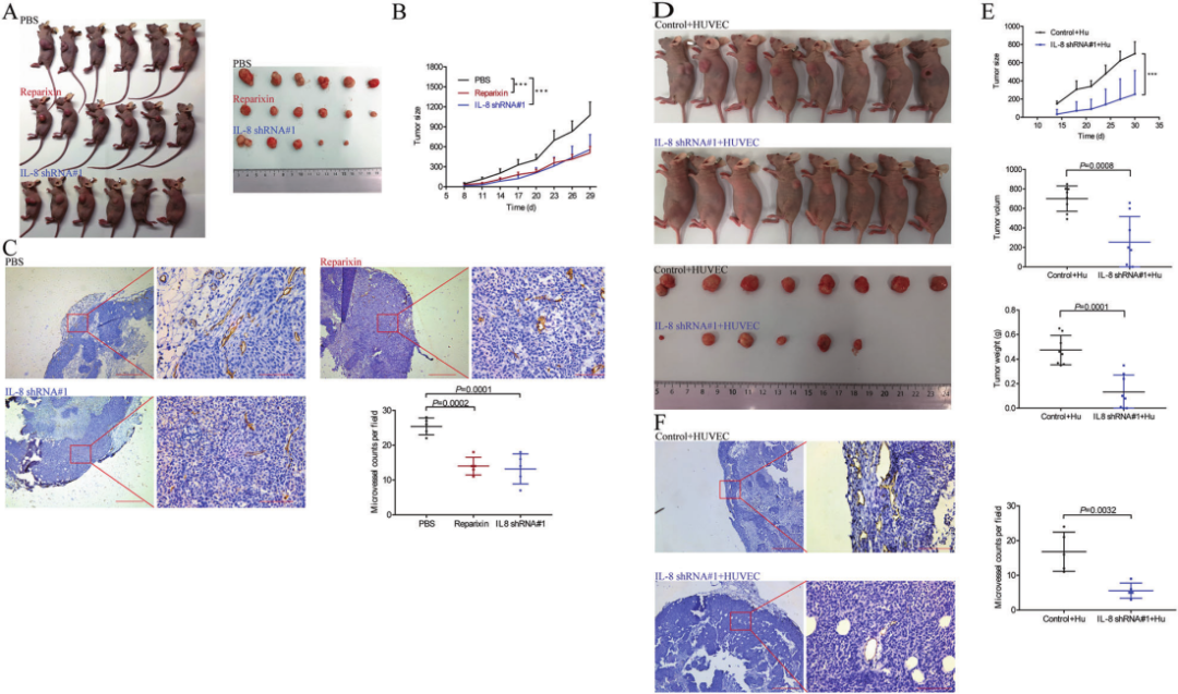 Cell Death Dis︱徐小燕团队揭示RNA编辑型AZIN1促进结肠癌血管生成的新机制 - 知乎