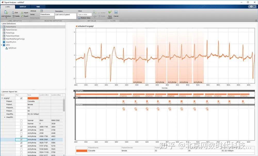 使用MATLAB实现信号处理的深度学习 - 知乎