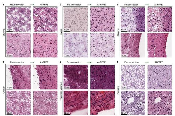 Nat Biomed Eng | 将组织图像从冷冻切片转变为FFPE的深度学习模型 - 知乎