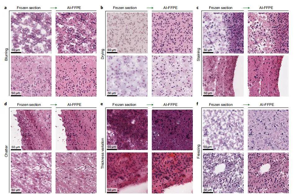 Nat Biomed Eng | 将组织图像从冷冻切片转变为FFPE的深度学习模型 - 知乎