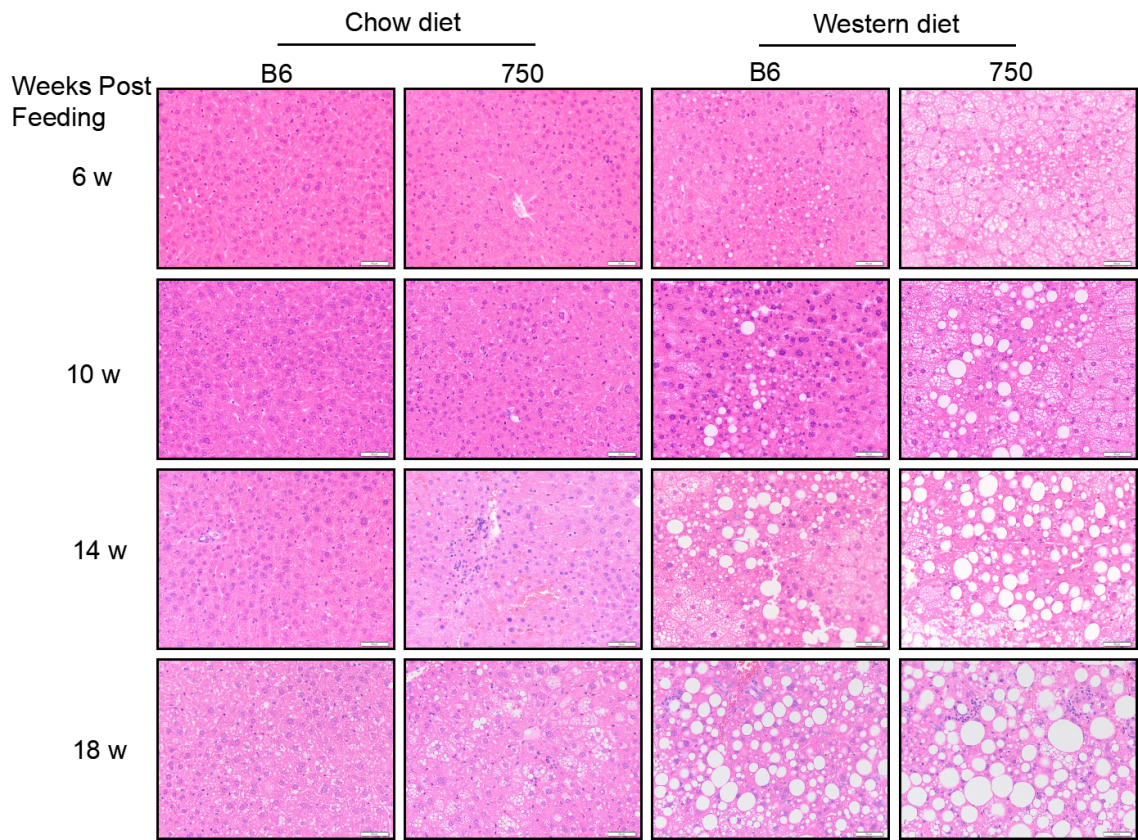 NASH研究新进展│Resmetirom获FDA授予突破性疗法认定 - 知乎