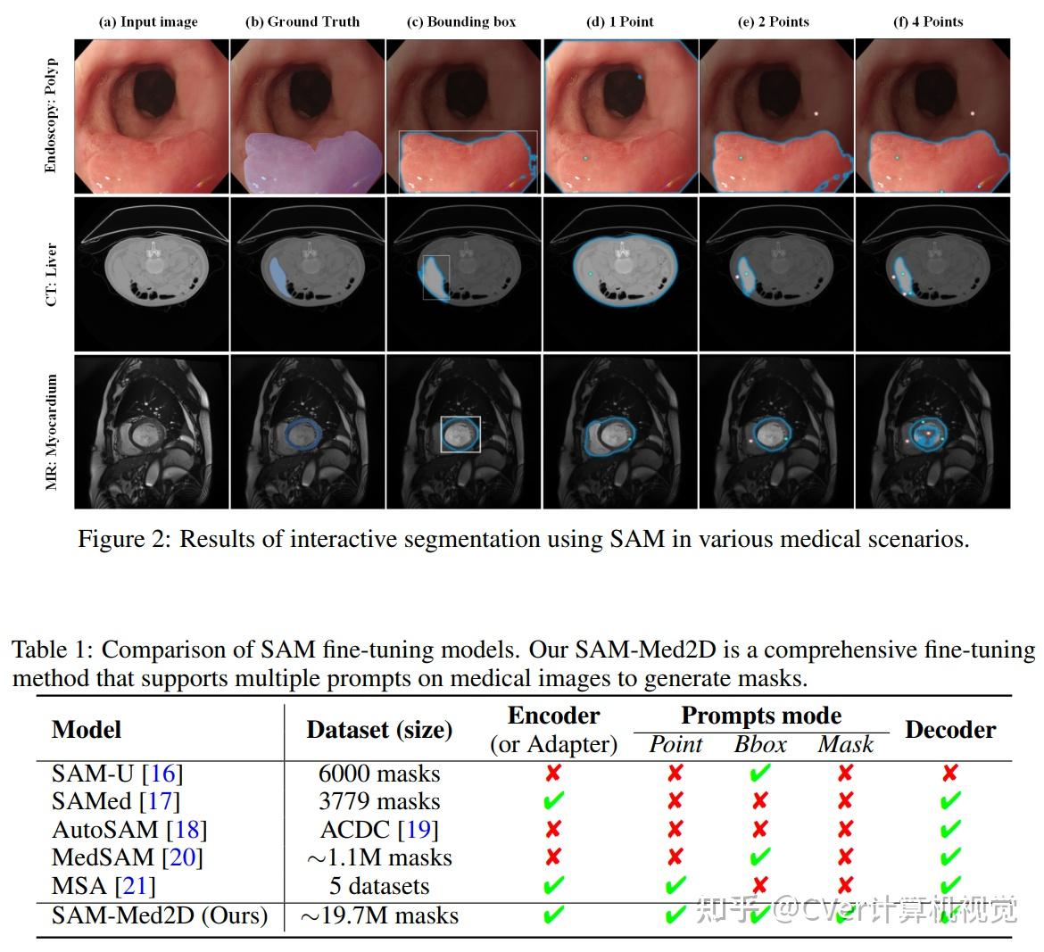 SAM-Med2D 医学图像分割来了！ - 知乎