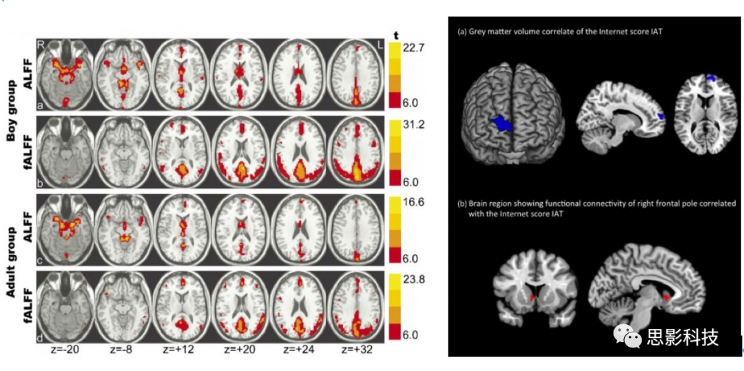 思影科技功能磁共振(fMRI)数据处理业务 - 知乎