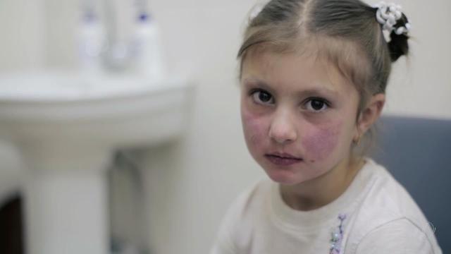 Rox Anderson：从激光医学之父到最成功的医生创业者 - 知乎