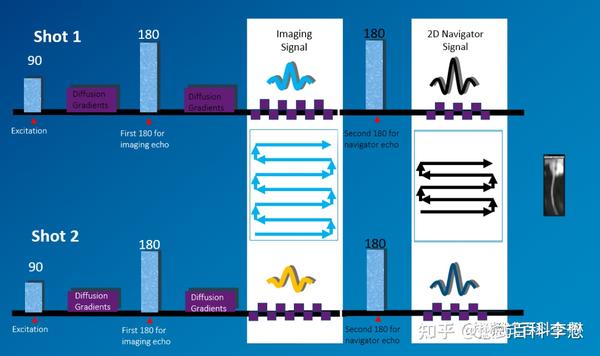 IRIS：多激发SE-EPI扩散（弥散）序列 - 知乎