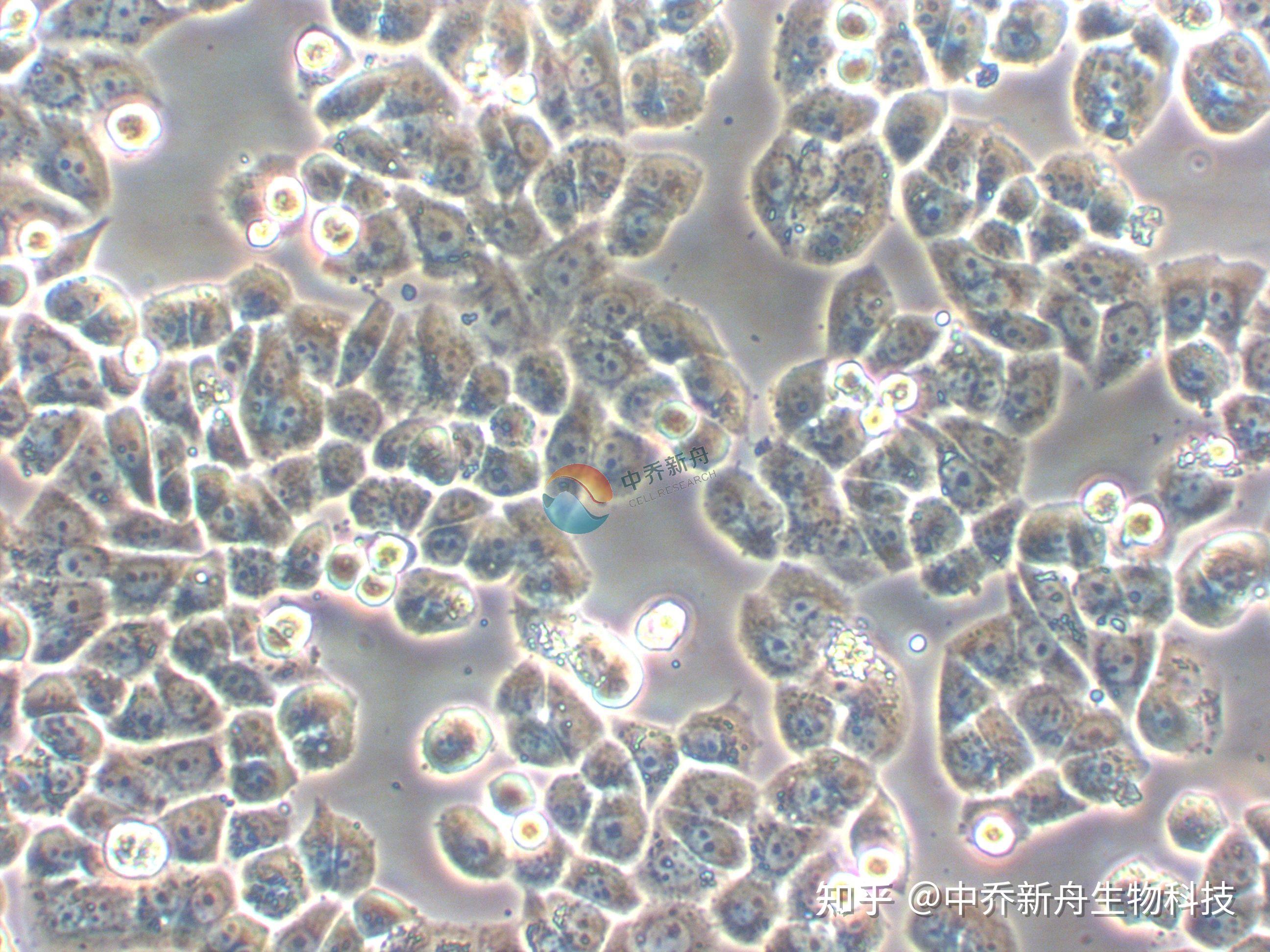 细胞学新手必看！快速掌握MDA-MB-468人乳腺癌细胞培养技术！ - 知乎