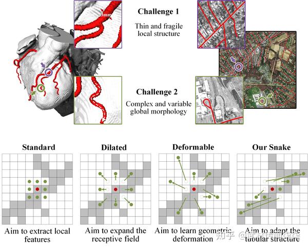 ICCV2023｜动态蛇形卷积（Dynamic Snake Convolution）用于管状结构分割 - 知乎