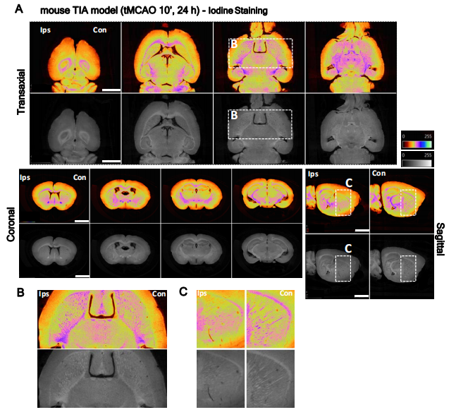 文献解读：小鼠中风模型 高分辨率micro-CT成像:从梗死表征到自动区域分割 - 知乎