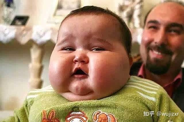小胖威利综合征（PRADER-WILLI SYNDROME; PWS）那些事儿 - 知乎