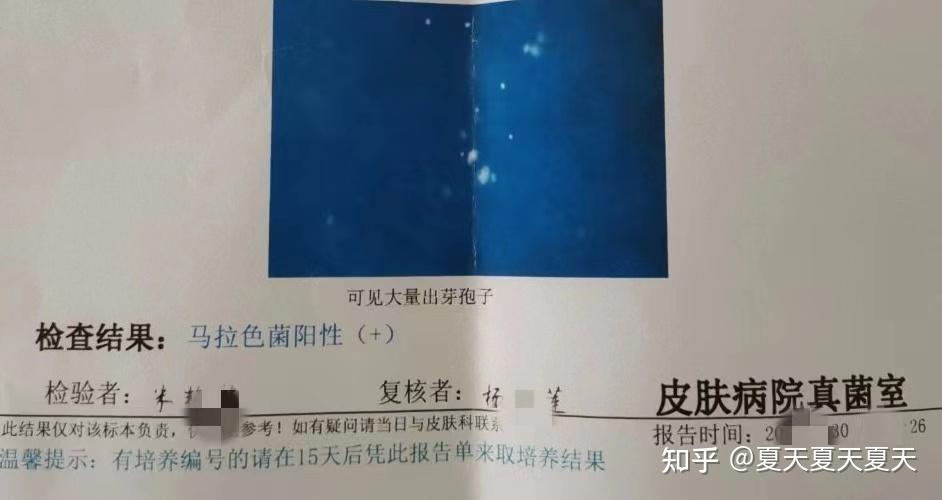 站在医学角度上来说,为什么黑头总是反反复复去不干净? 知乎