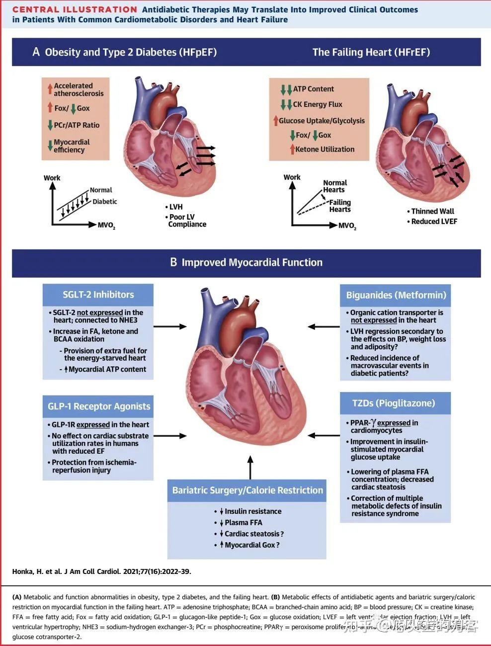 心肌代谢的治疗手法 - 知乎