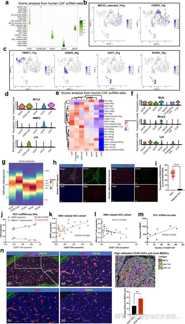IF 38 | CD36+癌相关成纤维细胞通过分泌巨噬细胞迁移抑制因子为肝细胞癌提供免疫抑制微环境 - 知乎
