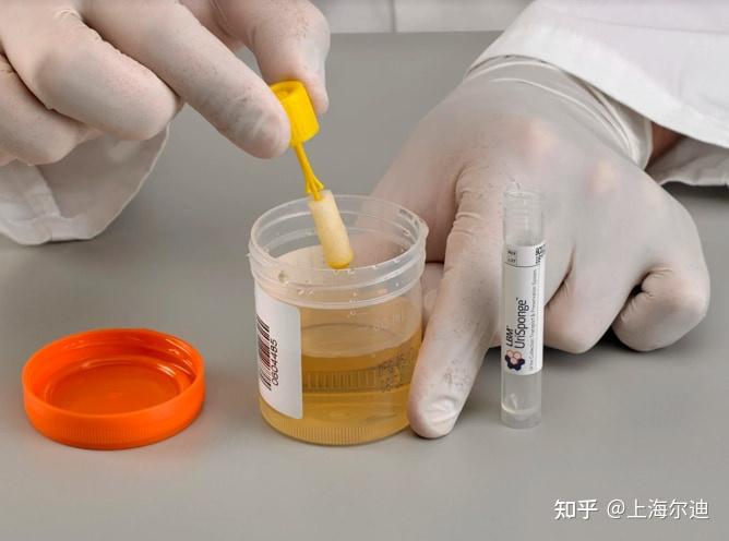 Copan尿液采集系统——Uri SWAB - 知乎