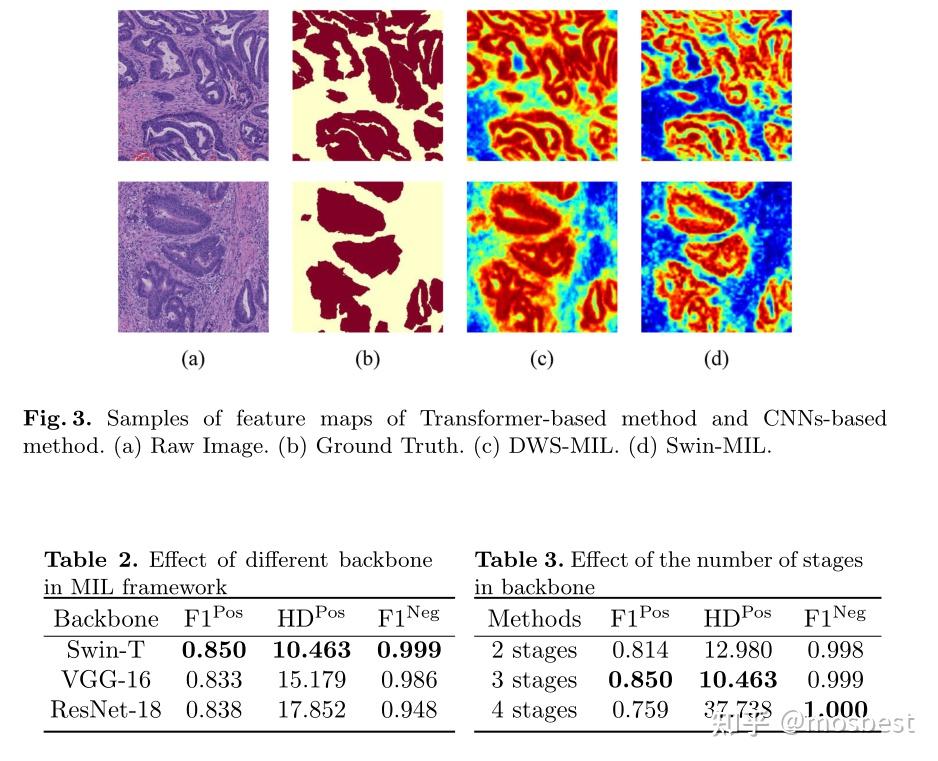 Transformer based multiple instance learning for weakly supervised histopathology image ...