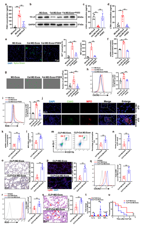 生物医学杂志丨IF：11丨M2巨噬细胞外泌体 通过抑制中性粒细胞NETs从而减轻脓毒症损伤 - 知乎