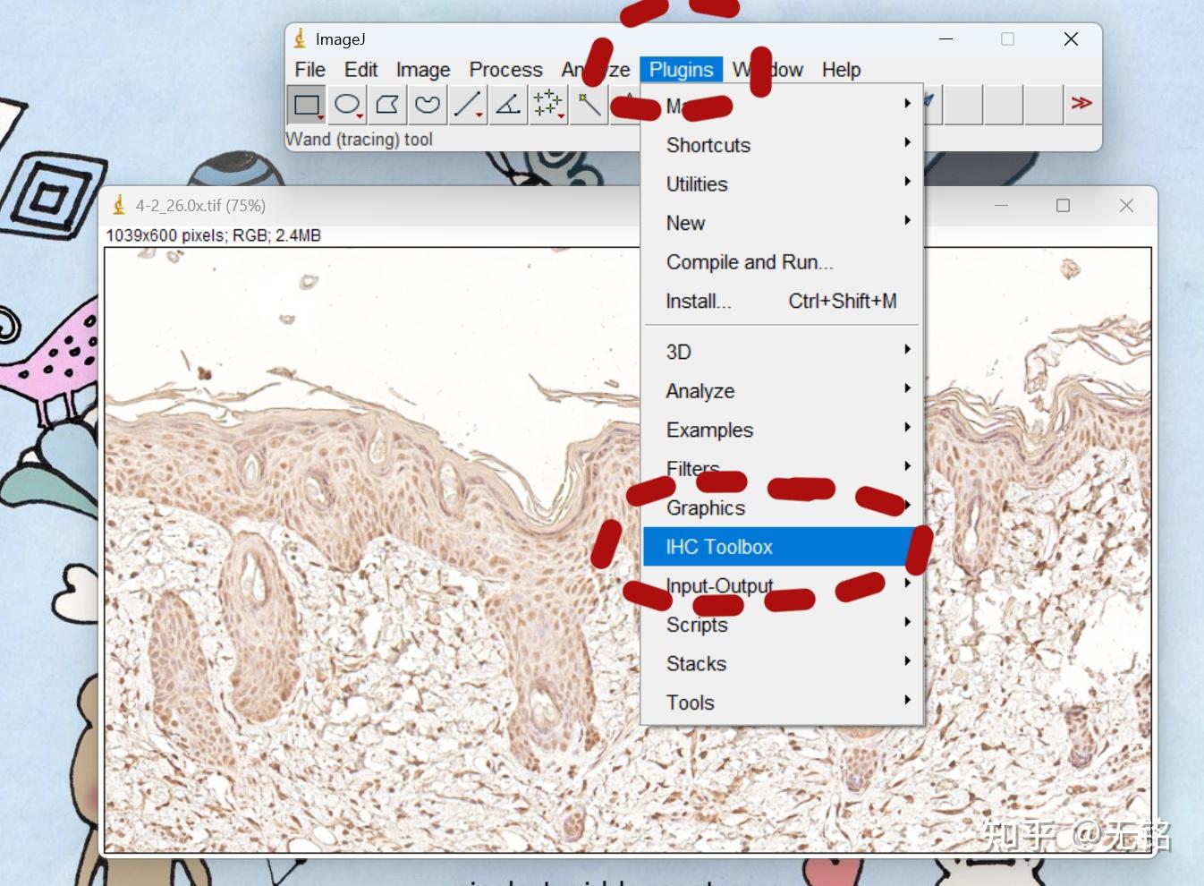 如何使用 imageJ 软件分析组织切片免疫组化面积？ - 知乎
