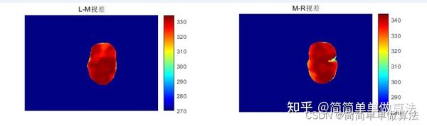 基于双目人脸图像ORB特征提取匹配的人脸三维点云提取和建模的matlab仿真 - 知乎