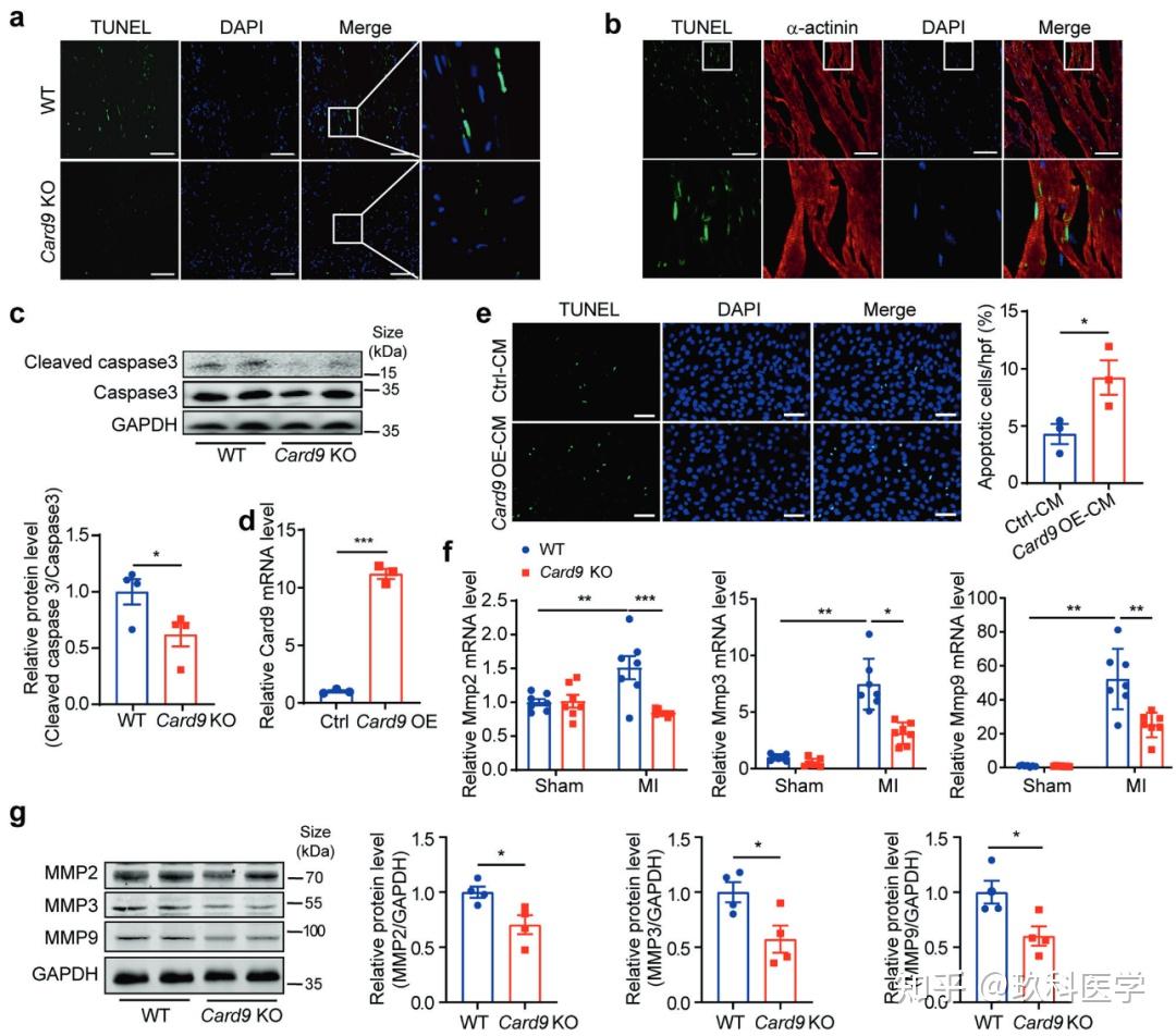 IF=39.3 巨噬细胞介导心梗后心肌损伤新机制 - 知乎