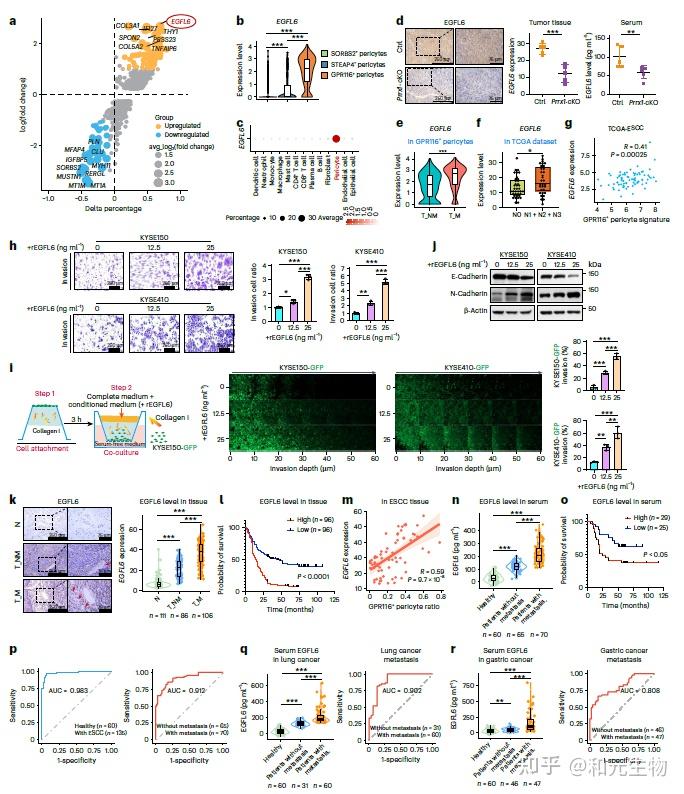 Nature genetics| ESCC GPR116+周细胞通过PRRX1-EGFL6-整合素β1-NF-kB轴调控肿瘤转移 - 知乎