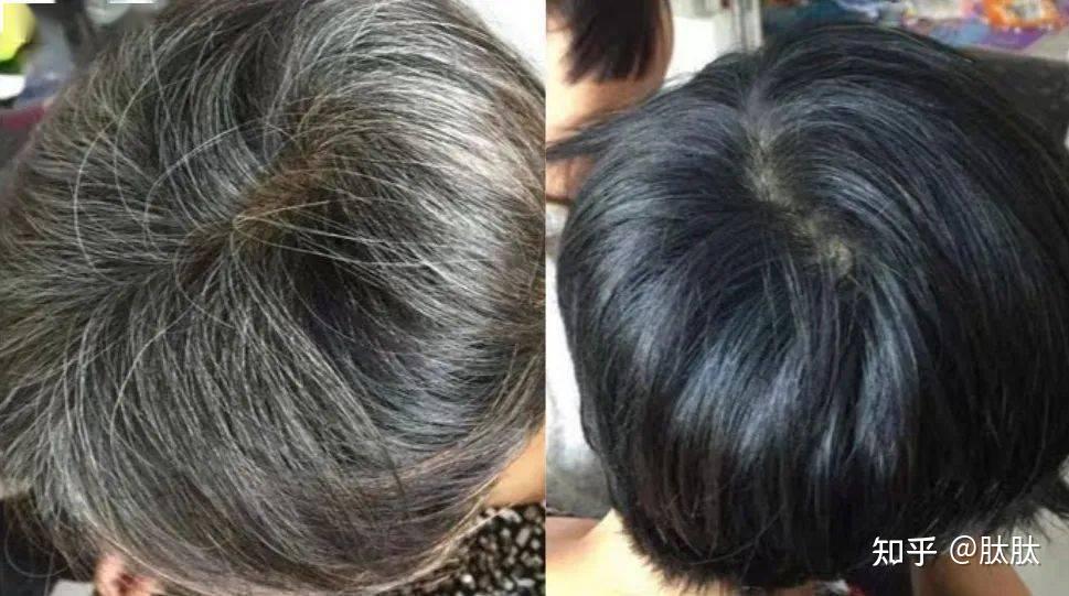 棕榈酰四肽-20/黑发肽/PALMITOYL TETRAPEPTIDE-20 - 知乎