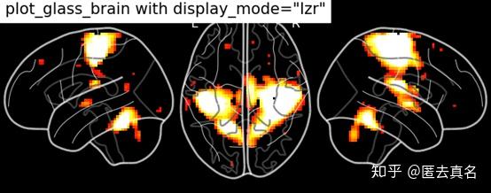 Nilearn：基于Python语言神经成像的机器学习（6） - 知乎