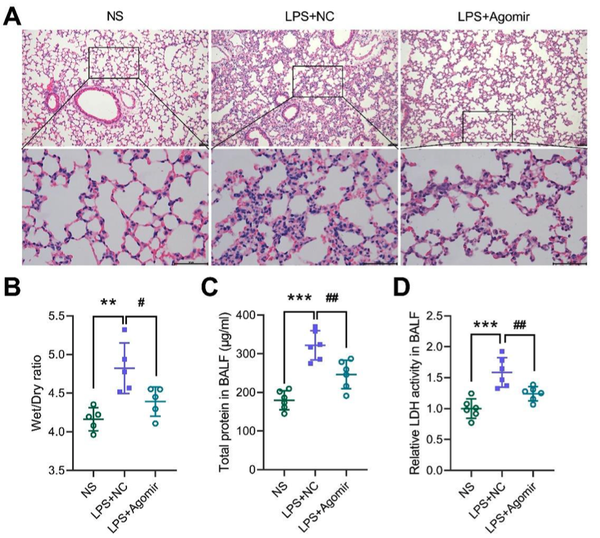 Aging and Disease丨IF：9.968丨MiR-29a-3p 通过减少肺泡上皮细胞全凋亡来改善急性肺损伤 - 知乎
