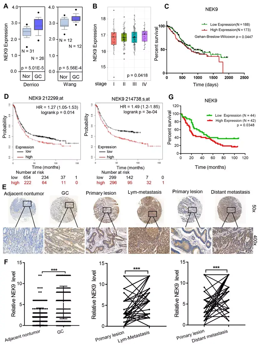Theranostics:空军军医大学第一附属医院团队揭示NEK9在细胞骨架及胃癌转移中作用和机制 - 知乎