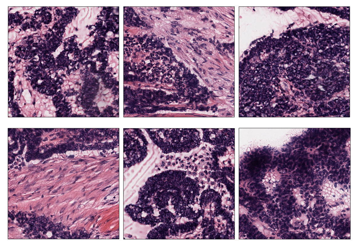 病理图像处理随笔(2)--WSI切片 - 知乎