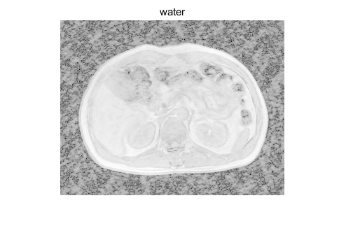 磁共振Dixon技术原理及初代算法解析 - 知乎