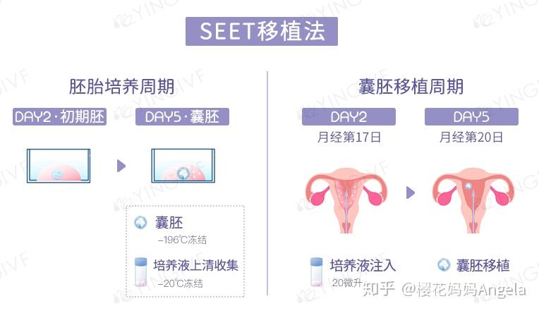 seet移植法，移植前多做这一步，成功率提升24% ｜ 英科技 - 知乎