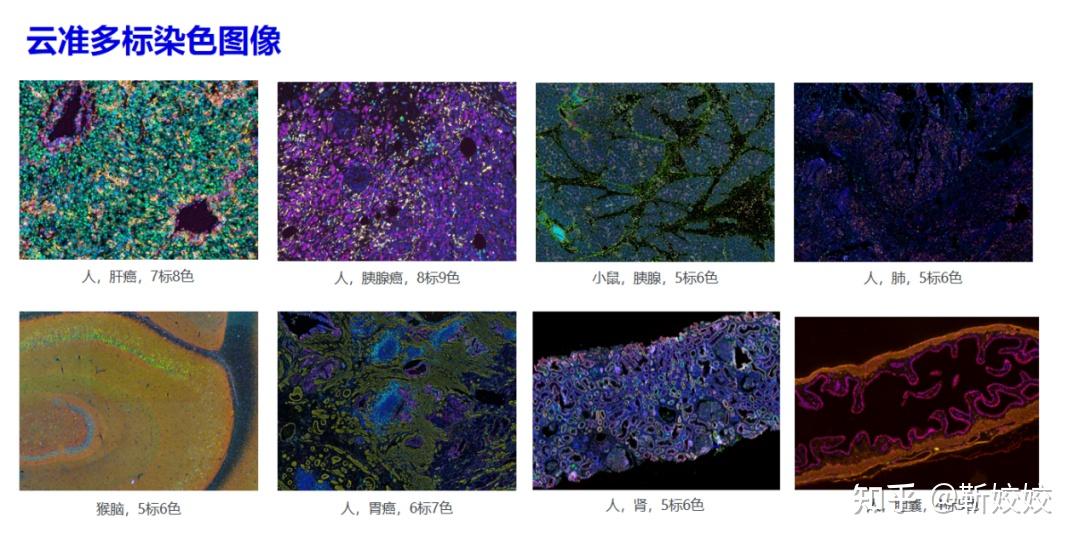 单细胞+空间 | 3种技术助力解锁FFPE样本中的新世界！ - 知乎