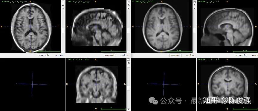 ULF-EnC2025——配对超低场 MRI 增强生成到高场 MRI - 知乎